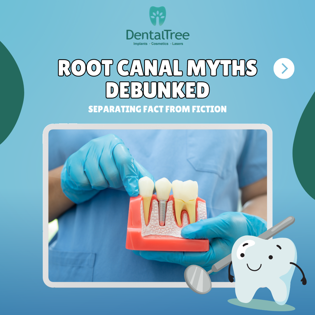 The Dental Implant Process: Start to Finish Guide | by Dentaltreedentalclinic | May, 2024 | Medium