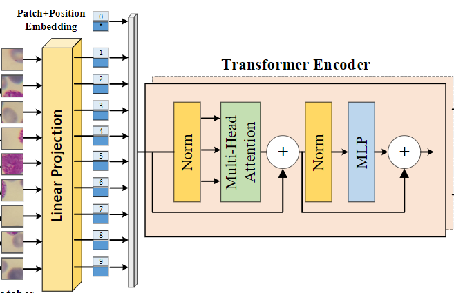 How to fine-tune Swin Transformer | Dev Genius