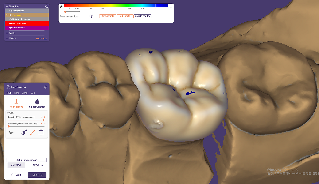 Week 6 Day 5: Wax-up And Cad Design | by Jung Lee | Apr, 2024 | Medium