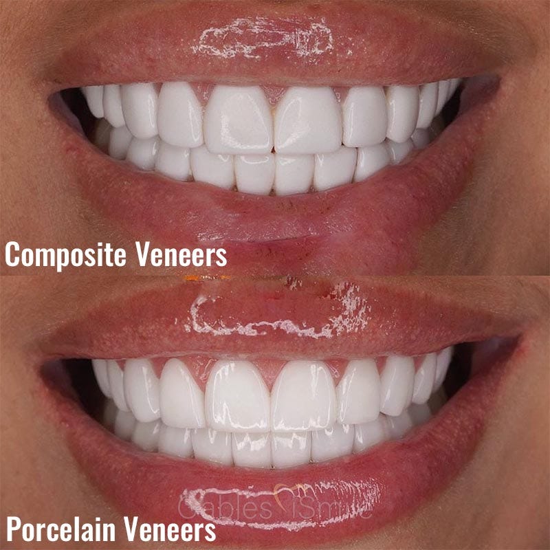 Understanding and Addressing Tooth Sensitivity: Causes, Prevention, and ...