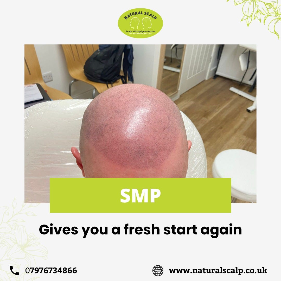 Get Fuller Hairline with Scalp Micropigmentation in Wales: A ...