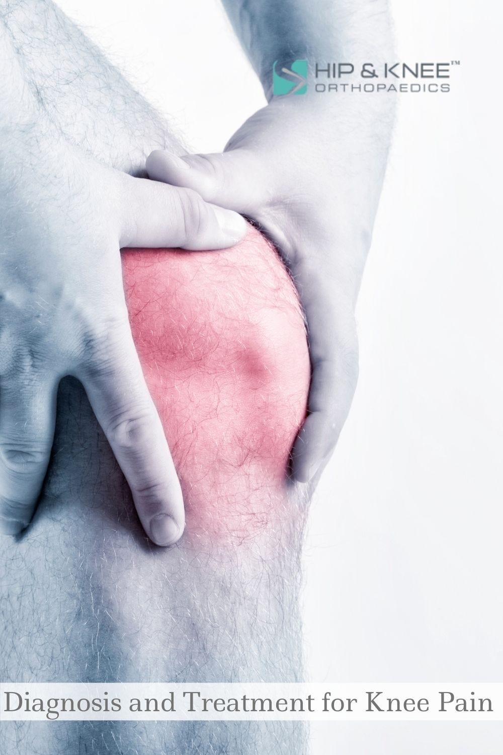 What Is Meniscus Repair and Meniscus Surgery | by Hip & Knee ...