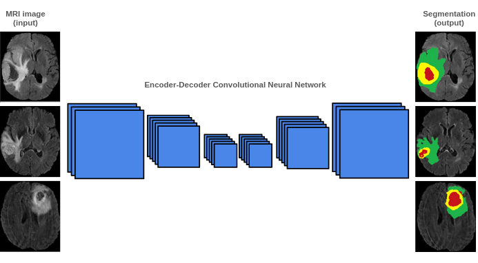 Exploring CNN Components for Tumor Segmentation in MRI Images: An Ablation Study | by Tannaz ...