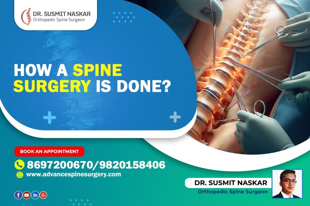 What to Know Before Your Spine Surgery | by Creatorssky | May, 2024 ...