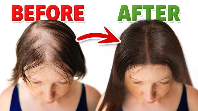 How to Grow Thick and Healthy Hair: Nutrients and Tips | by Mauryayush ...
