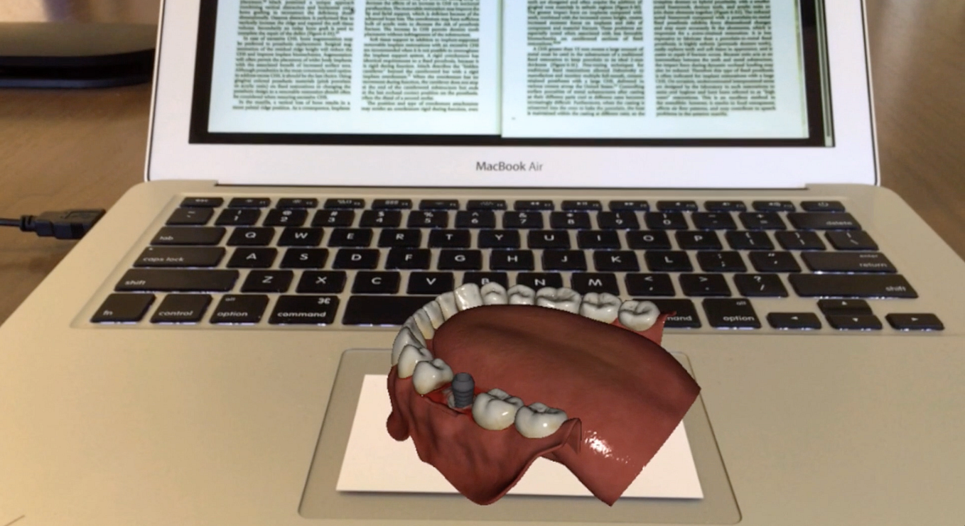 All you need to know about Vertical Preparations | by Dr Kevin Ho ...