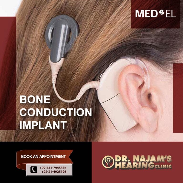 Cochlear Implant Cost in Pakistan | by Cochlearimplantcost | Medium