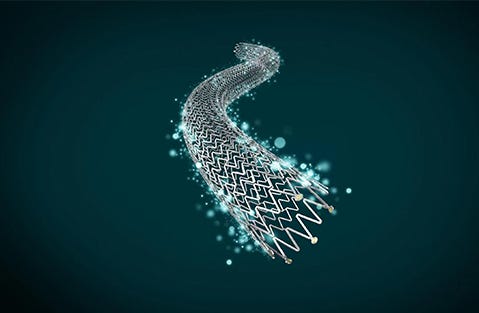 Peripheral Stent System. OVERVIEW | by zyloxtb | Aug, 2024 | Medium