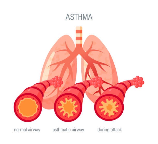 Exploring Common Homeopathic Remedies for PCOD/PCOS | by utkrash ...