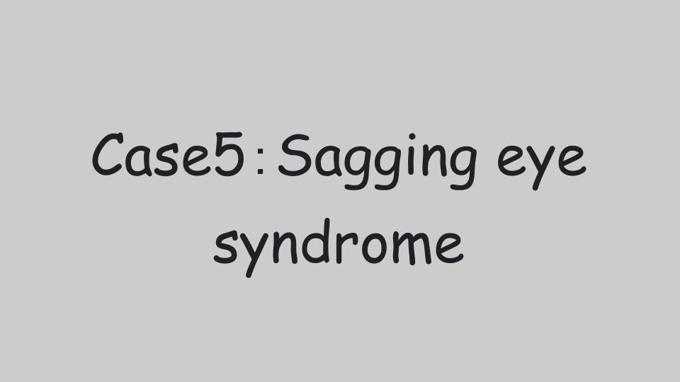 Case 5–1: Is it really age? Sagging Eye Syndrome | by neuro-opthal | Medium