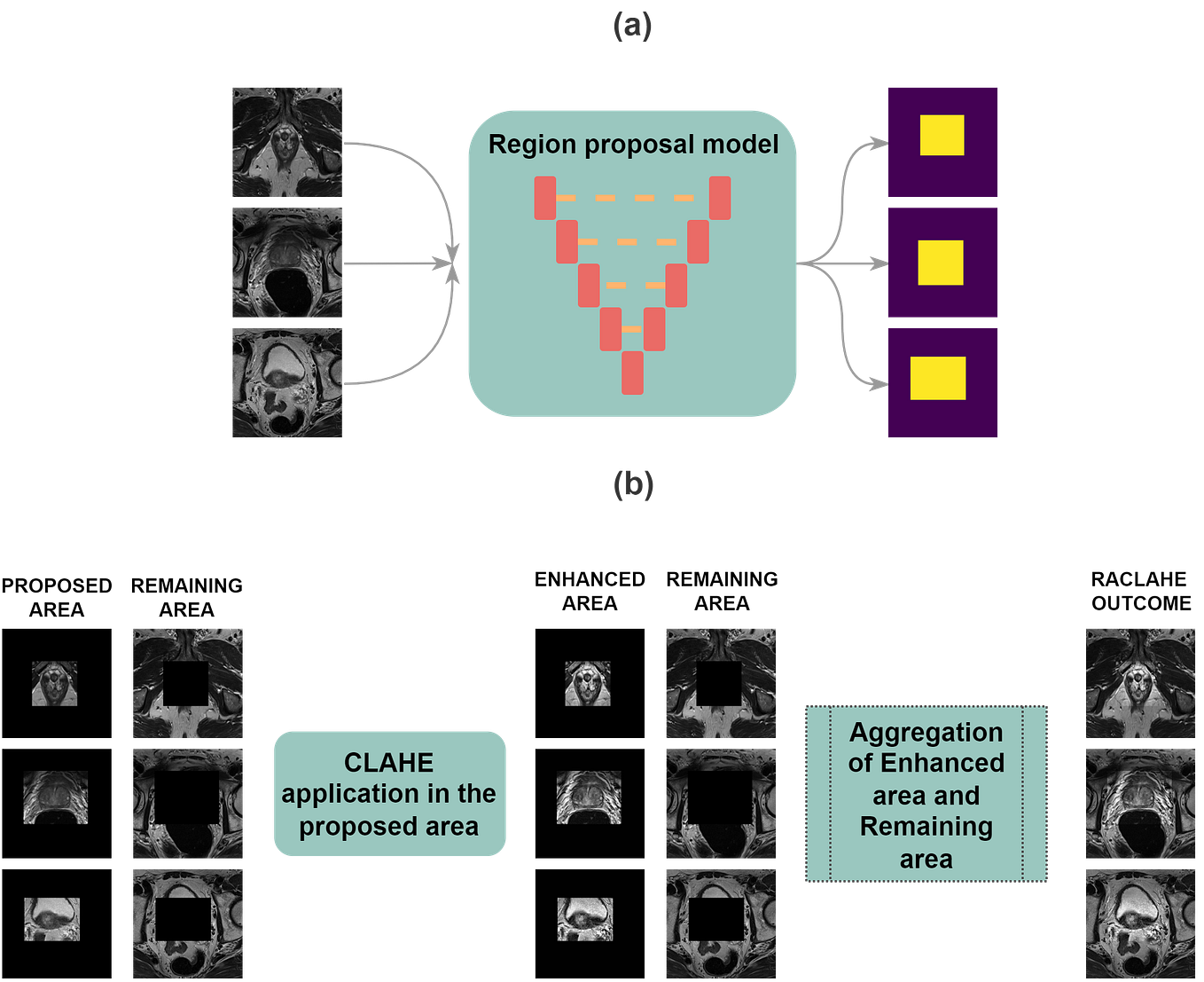 ProLesA-Net: A multi-channel 3D architecture for prostate MRI lesion ...