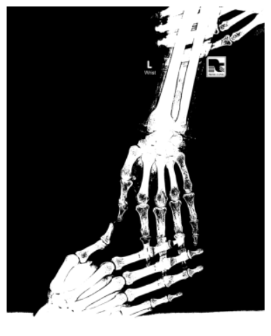 Image Filtering Techniques in Image Processing — Part 1 | by Henrique ...