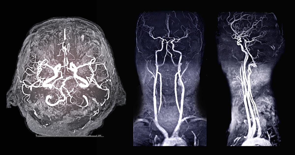 Magnetic Resonance Imaging (MRI) - MRIPETCTSOURCE - Medium