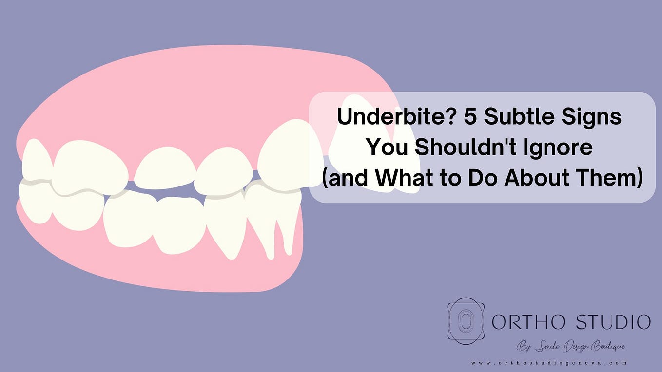 Say Goodbye to Overbite: Your Guide to a More Confident Smile | by ...