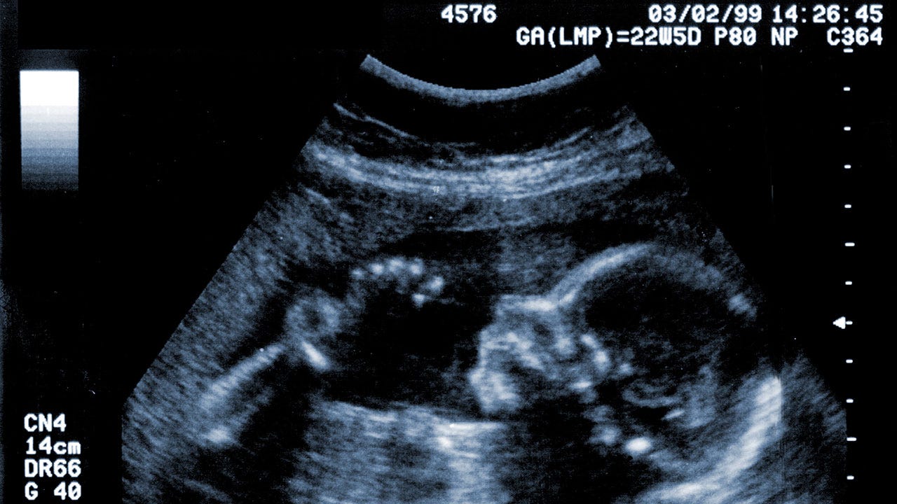 How to Know the Health Condition of Your Baby? | by Fetal Medicine | Medium