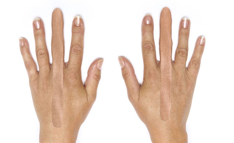 Dupuytren’s Contracture Treatment | by DupuyTren Wand | Medium
