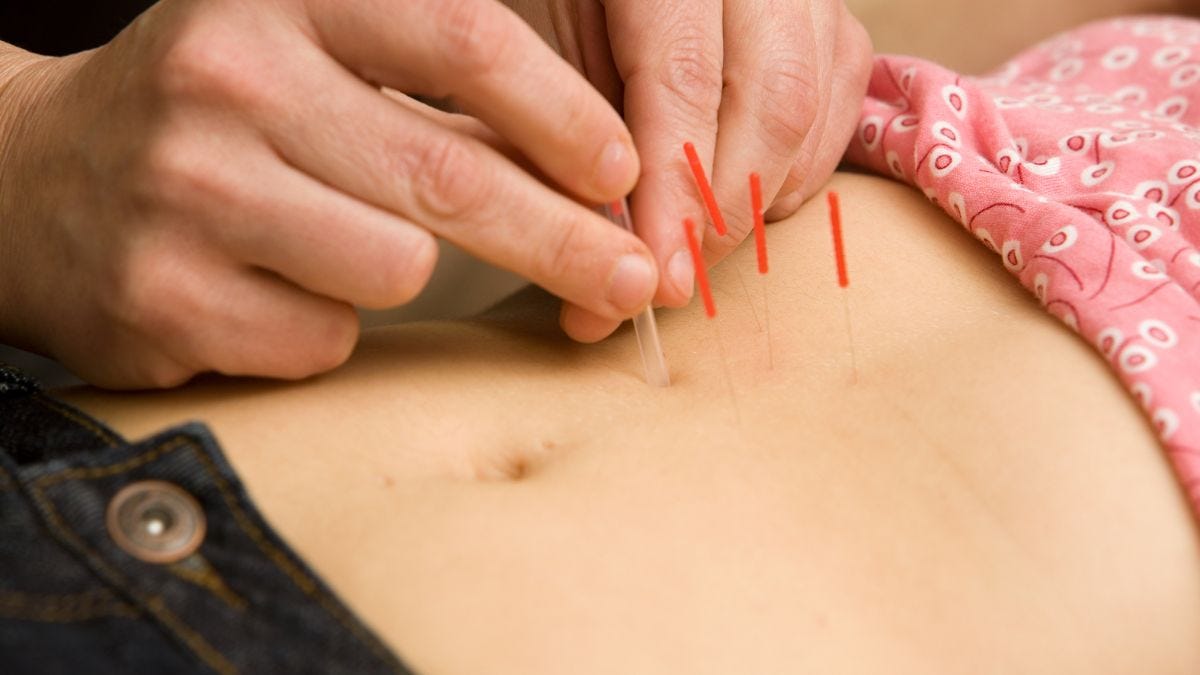 Migraines and Weather Shifts: Why May Brings More Headaches and How Acupuncture Can Help | by ...