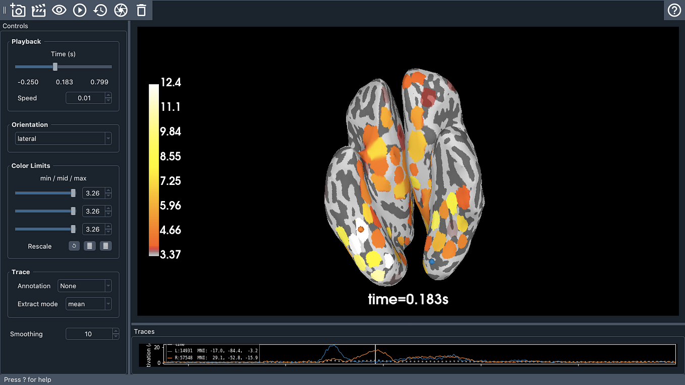 An Introduction to Brain-Computer Interfaces | by Adam Gulamhusein ...