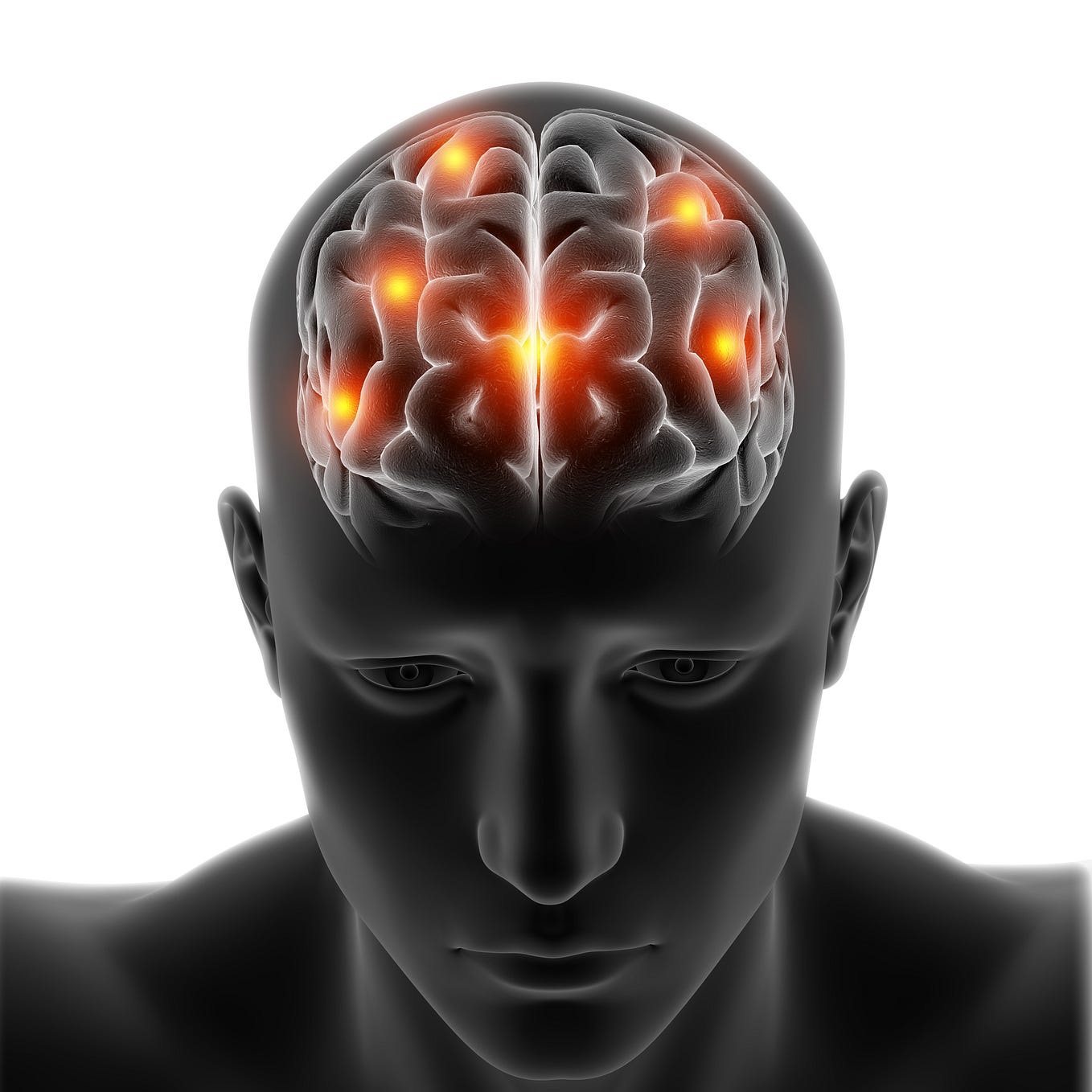 Best MRI Brain Scan Centers Near You in Chandigarh: A Complete Guide ...