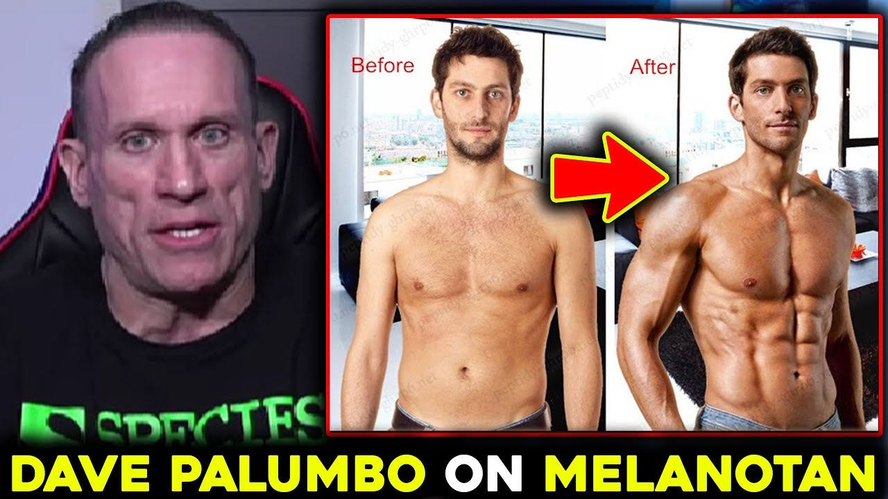 **Melanotan Before and After: Achieving a Sun-Kissed Glow Safely** | by Melanotan | Medium