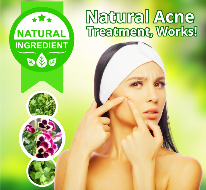 Acne Best Practice Management: A Guide to Clearer Skin | by Marcoluggi ...