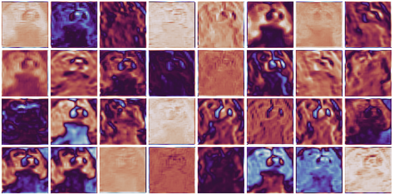 Converting PyTorch Model to Keras: A Step-by-Step Tutorial | by Dr Roushanak Rahmat | Code Like ...