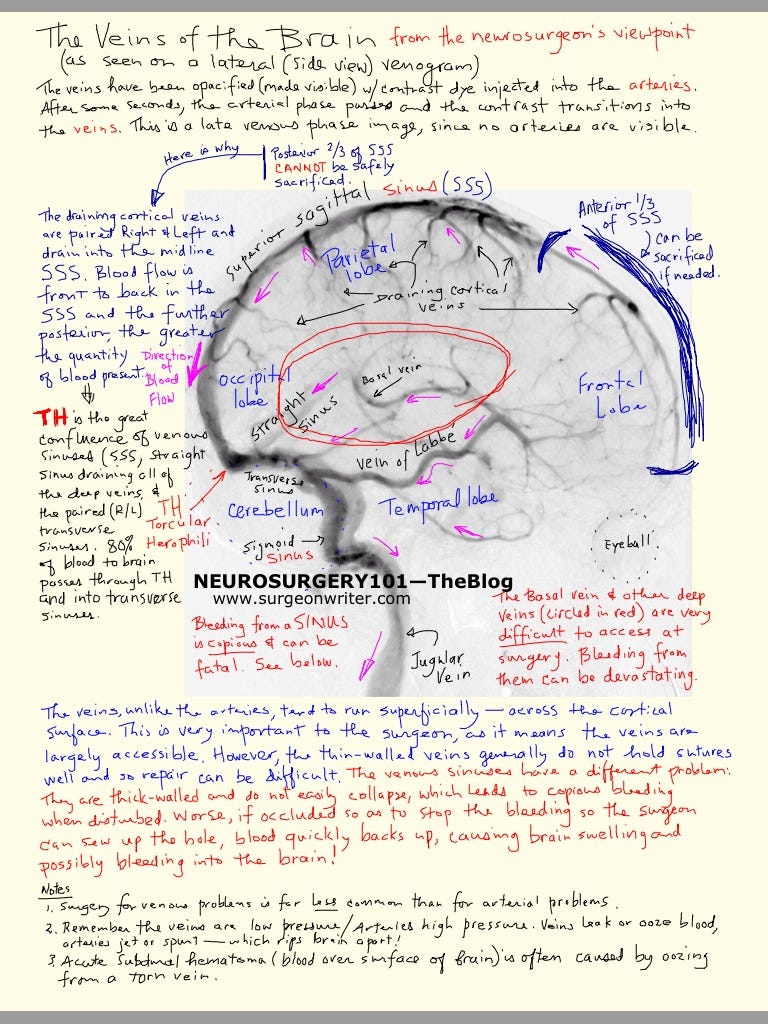 Brain Squeeze: The Intracranial Pressure Monster | by Edison McDaniels ...