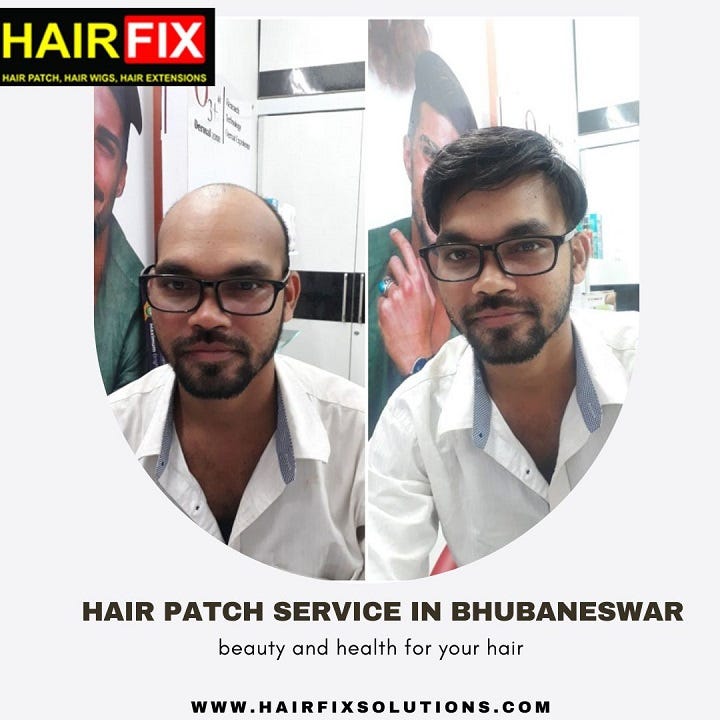 The Complete Guide to Hair Patch Services: Everything You Need to Know ...