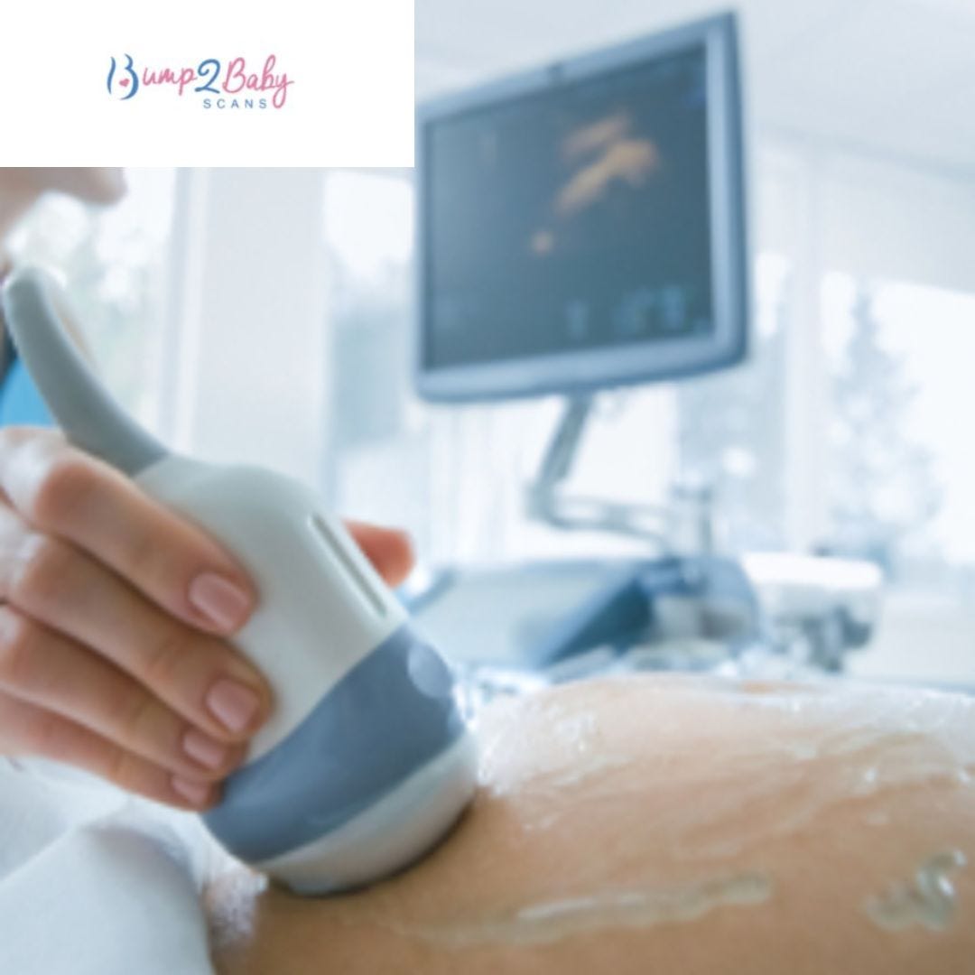 How to Prepare Emotionally and Physically for Your 12-Week Private Scan | by Bump2babyscans ...
