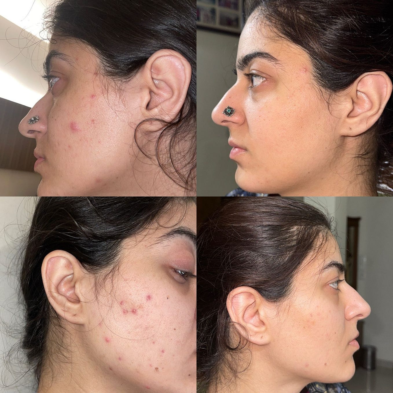 TUOB — Traditional Home Remedy In The Philippines | by Elvie ️ Lins ...