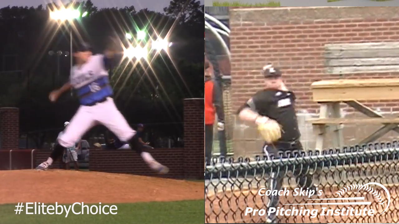 WHAT YOUR MOTION NEEDS - Skip Fast - Medium