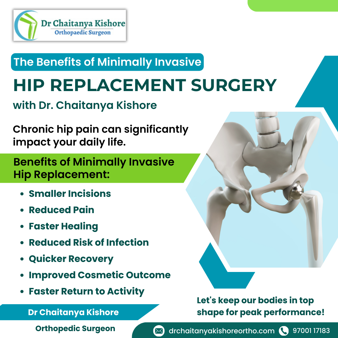 Reclaim Your Active Life: Minimally Invasive Hip Replacement with Dr ...