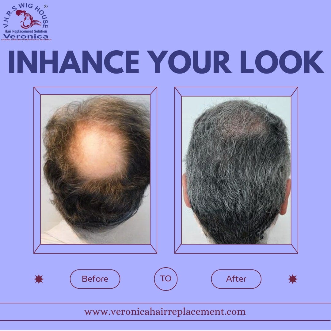 Best Non-Surgical Hair Replacement Solution in Delhi | Veronica Wig ...