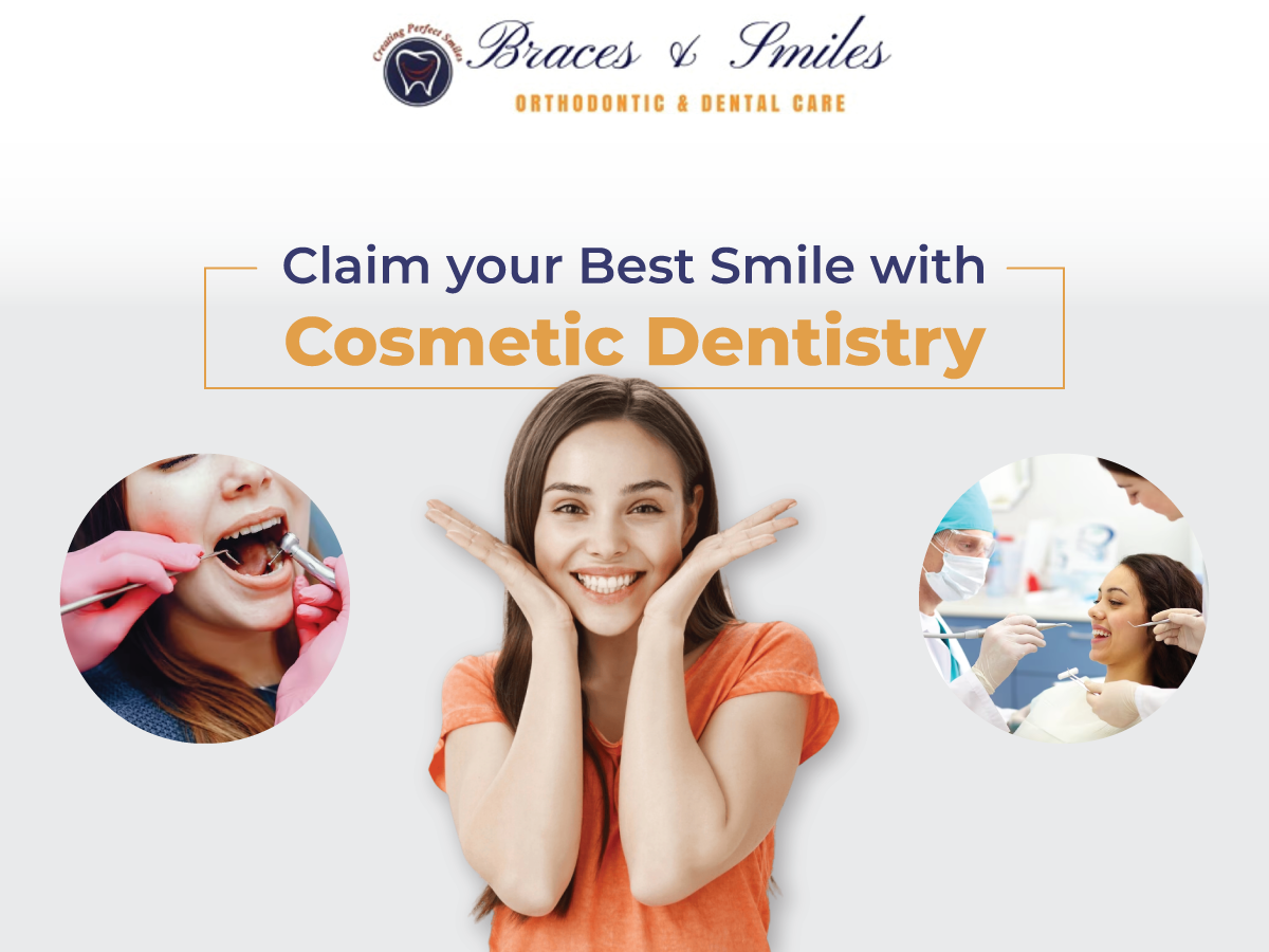 Dental Crown And Bridges in Pune | Crowns and Bridges in Viman Nagar | Crowns and Bridges in ...