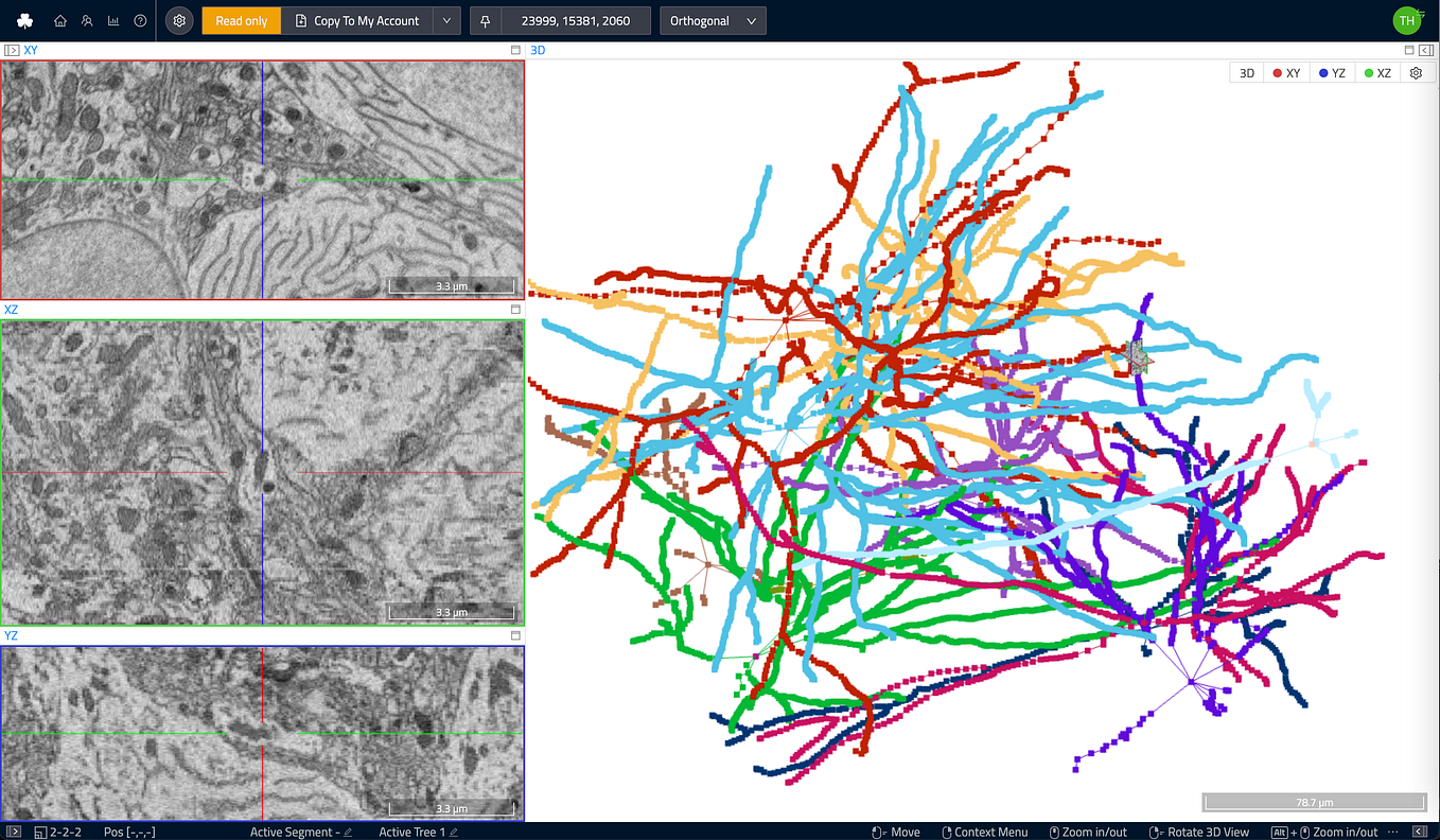 Automated Neuron Reconstruction. Creating a fully automated neuron… | by Tom Herold | WEBKNOSSOS ...