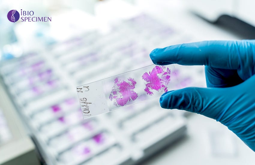 Unlocking the Secrets of Human FFPE Tissue Samples | by IBio Specimen ...