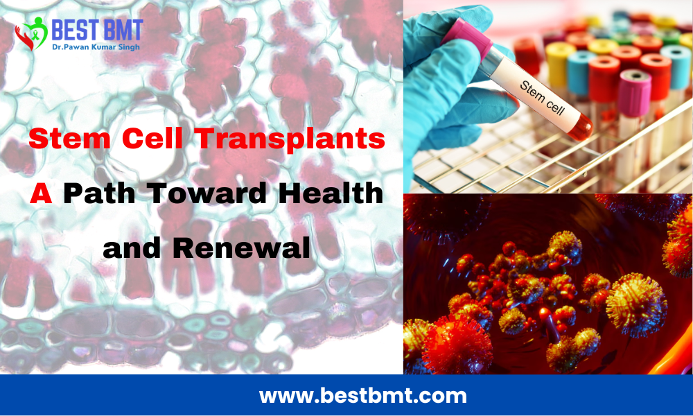 A Brighter Future Peripheral Blood Stem Cell Transplant | by Dr Pawan ...