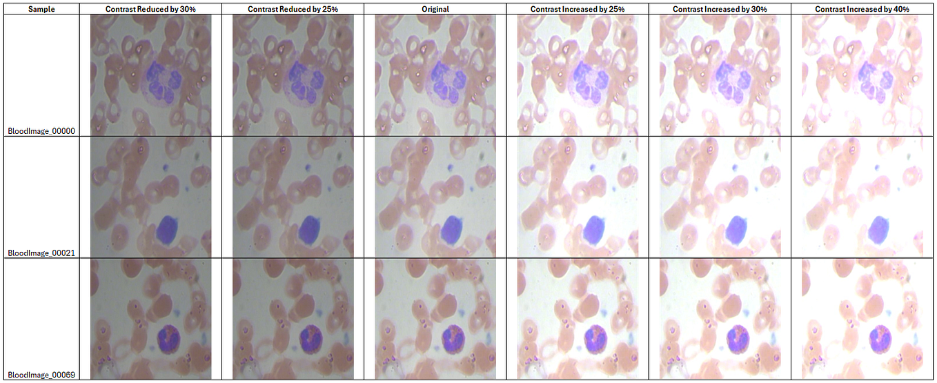 Use cases of Image Segmentation Using Deep Learning | by Rayan Potter ...