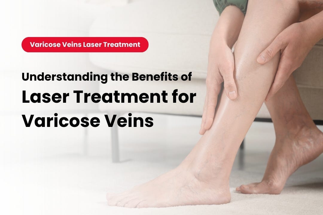 7 Ways to Heal Well Following Varicose Vein Laser Treatment - Dr Jathin ...