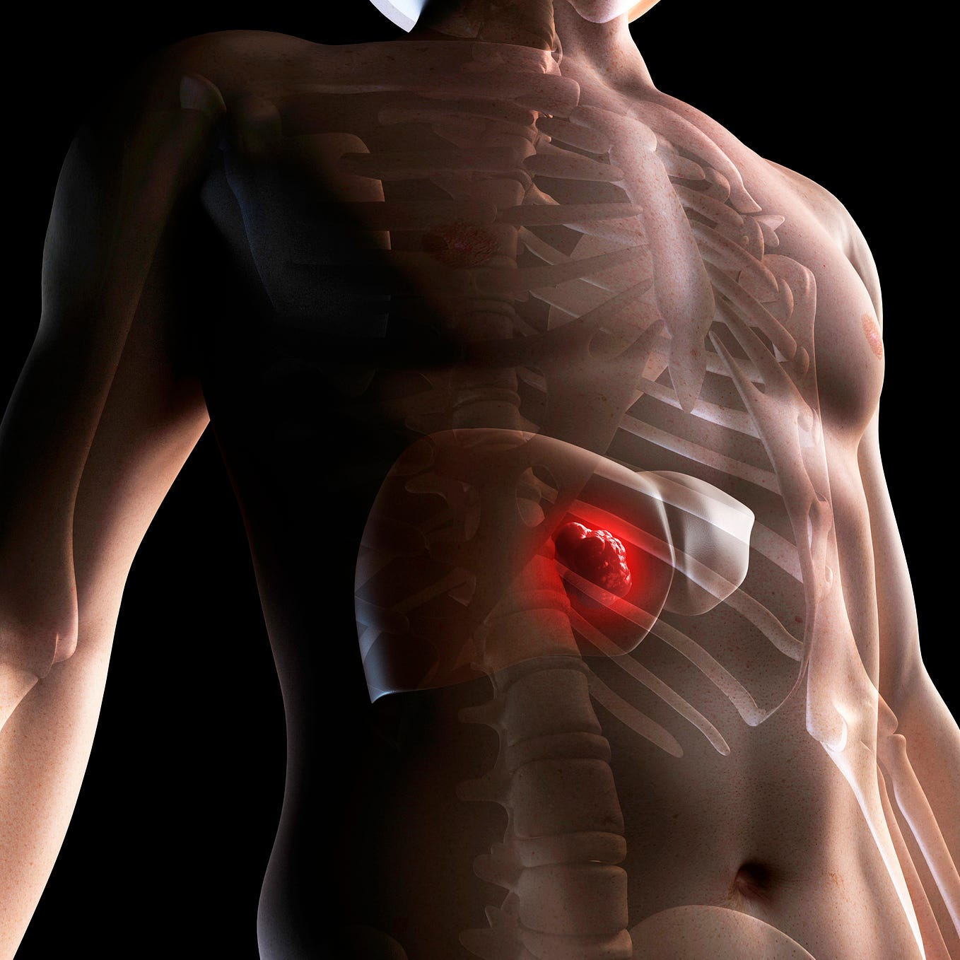 Do You Have Liver Damage? Important Liver Questions to Ask Your Doctor ...