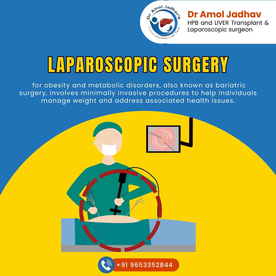 Patient Selection for Laparoscopic Surgery | Dr. Amol Jadhav | Best Liver Surgeon in Pune | by ...