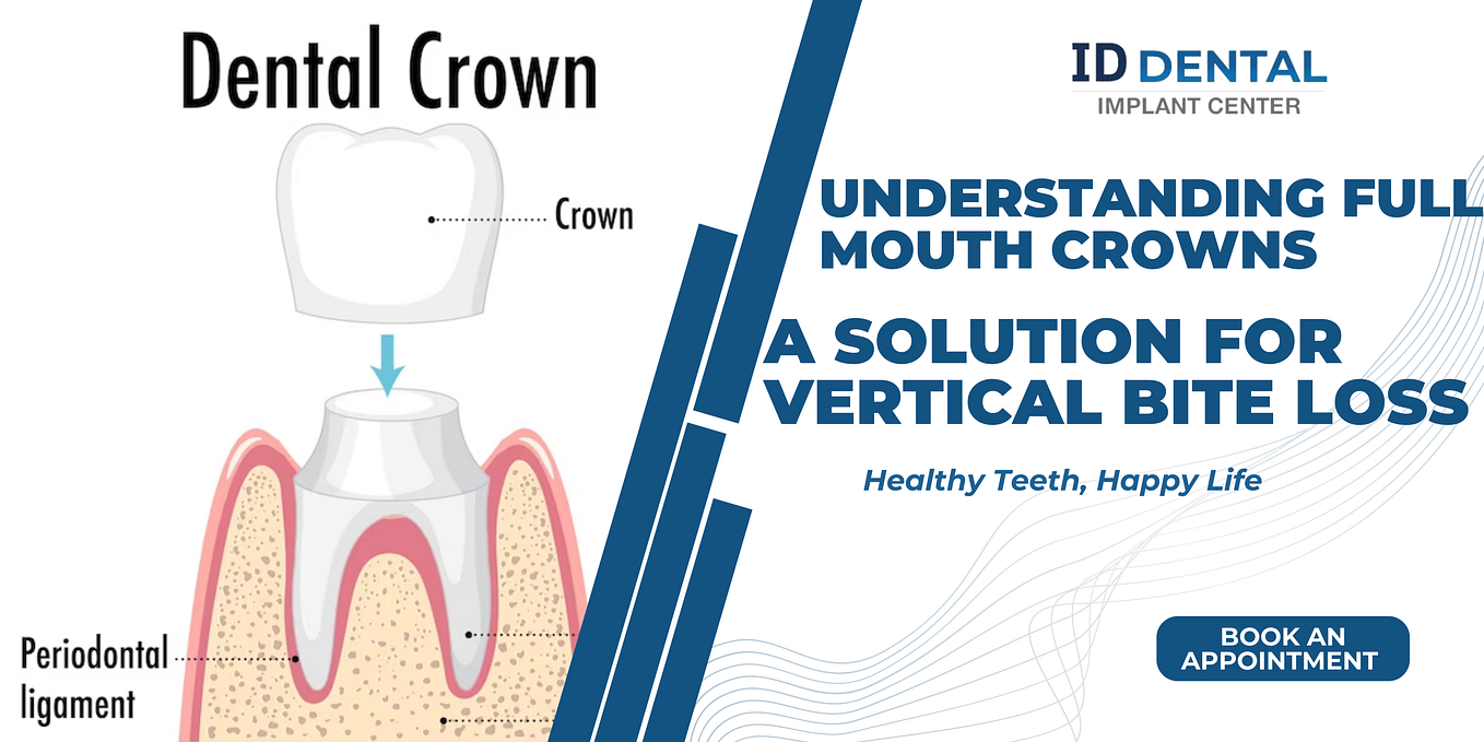 Benefits Of Dental Implants for Recovery Of Your Smile | by ID Dental ...