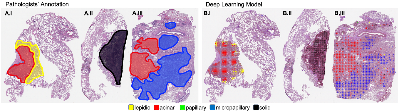 Classification of Histopathology Images with Deep Learning: A Practical ...