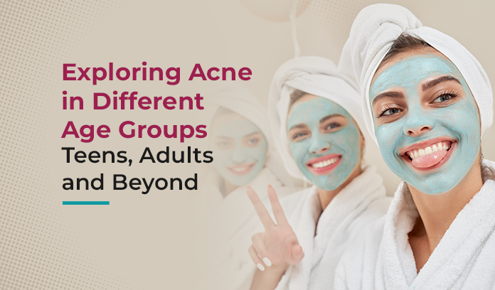 Understanding The Difference Between Acne Marks vs Acne Scars | by Acne ...