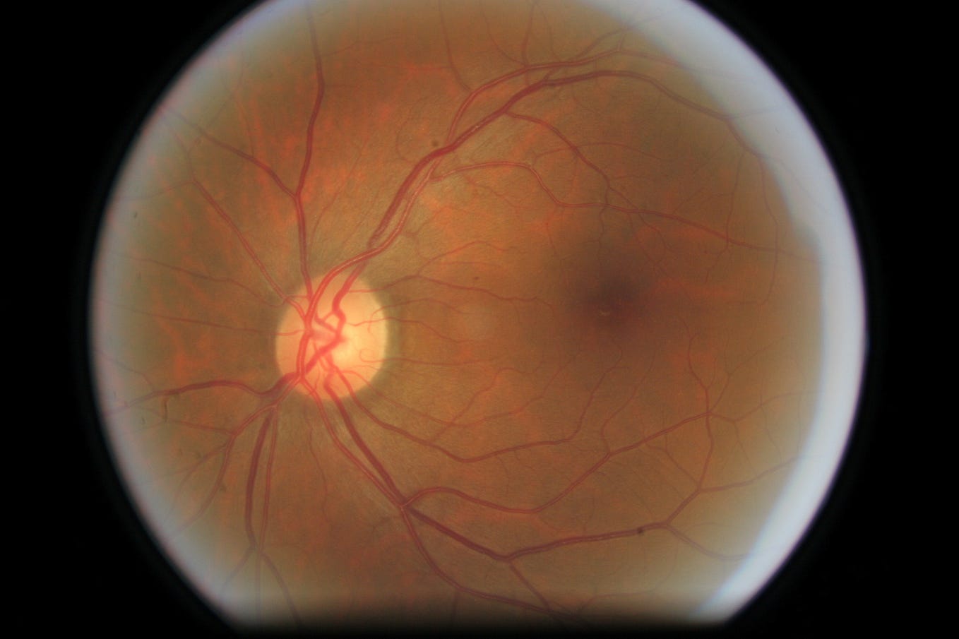 Autoencoders With Pytorch Auto Encoders Are Self Supervised A By Shivang Ganjoo Medium