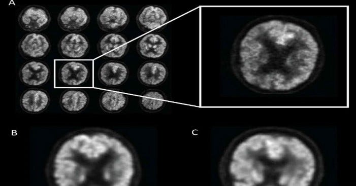 AI in Healthcare III: Continuous Care Domain | by Ayowole Delegan | Oct ...