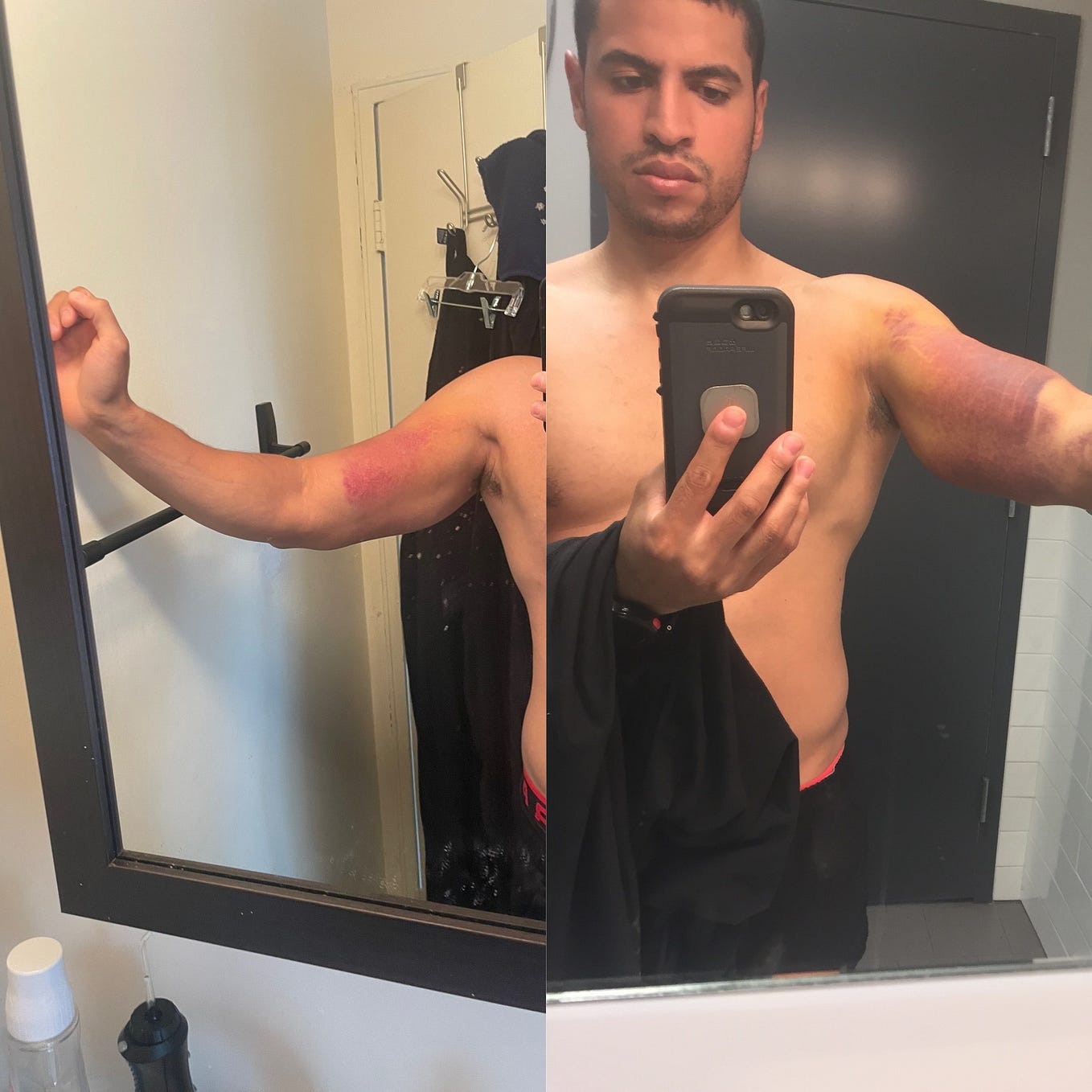 8 Exercises for Incredible Grip Strength | by Mark Barroso | Medium
