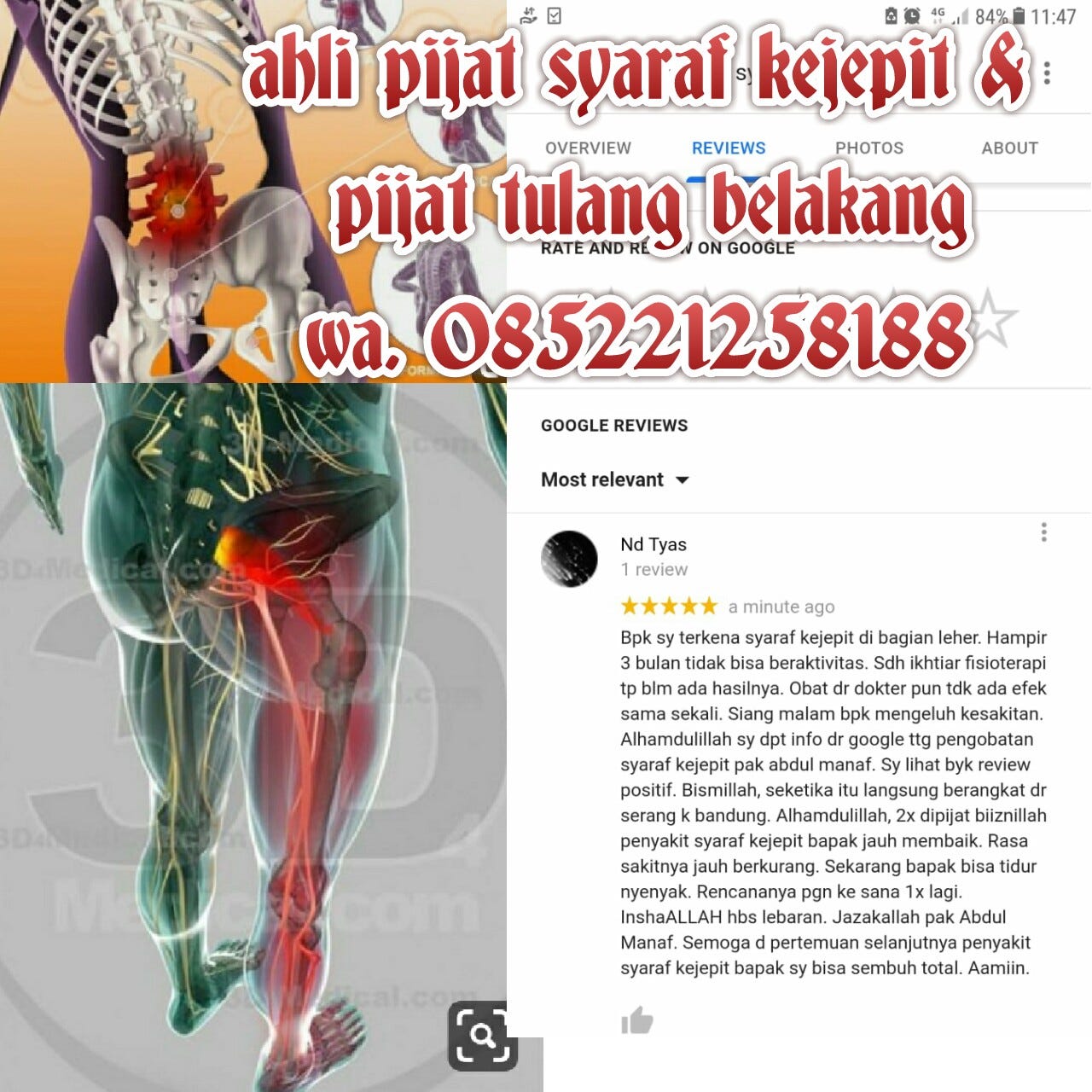 Penyebab dan Gejala Saraf Terjepit Cervical. | by Pengobatan syaraf kejepit abdul manaf bandung ...