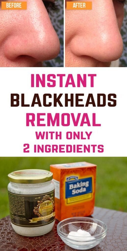 Famous Dermatologist Revealed: Remove Brown Spots On Face And Skin With ...