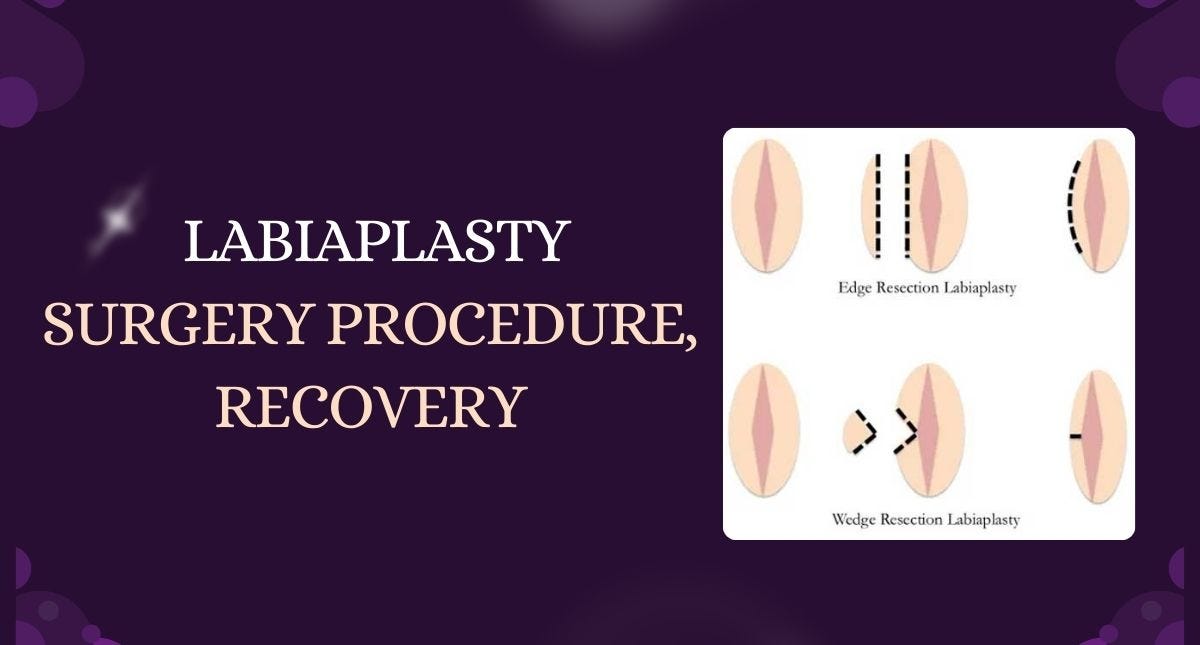 Vaginal Surgery: Understanding Labiaplasty and Hymenoplasty | by Dr. Manisha Jain | Jun, 2024 ...